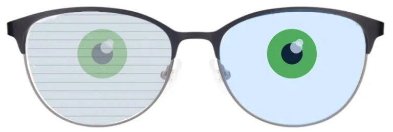 Wie wird eine Prismenfolie an der Brille angebracht? - Die ...